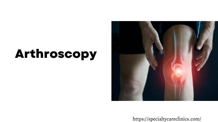 PPT - Arthroscopy PowerPoint Presentation, free download - ID:11316191