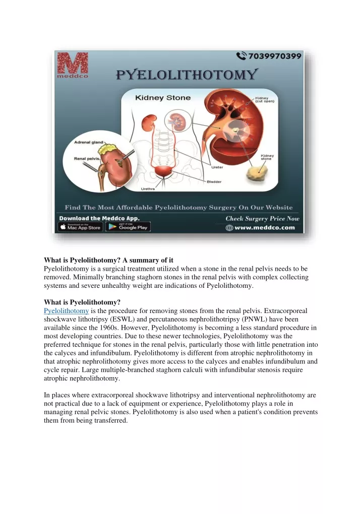 PPT - What is Pyelolithotomy 1804202-converted PowerPoint Presentation ...