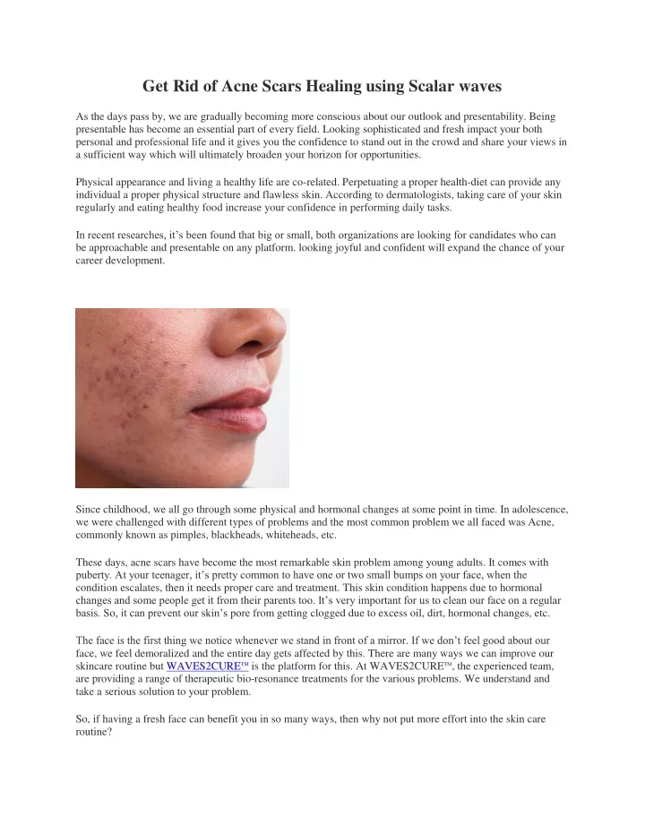 PPT - Get Rid of Acne Scars Healing using Scalar waves PowerPoint ... PPT - Get Rid of Acne Scars Healing using Scalar waves PowerPoint ...