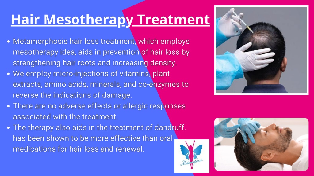 PPT - Improve the Volume Of Your Hair with Hair Fall Mesotherapy ...