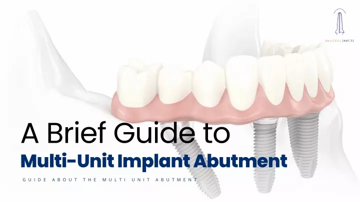 PPT - A Brief Guide to Multi-Unit Implant Abutment PowerPoint ...