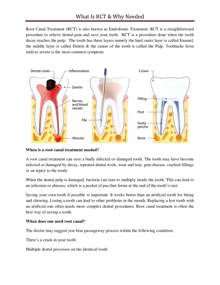 PPT - What Is RCT & Why Needed PowerPoint Presentation, free download ...