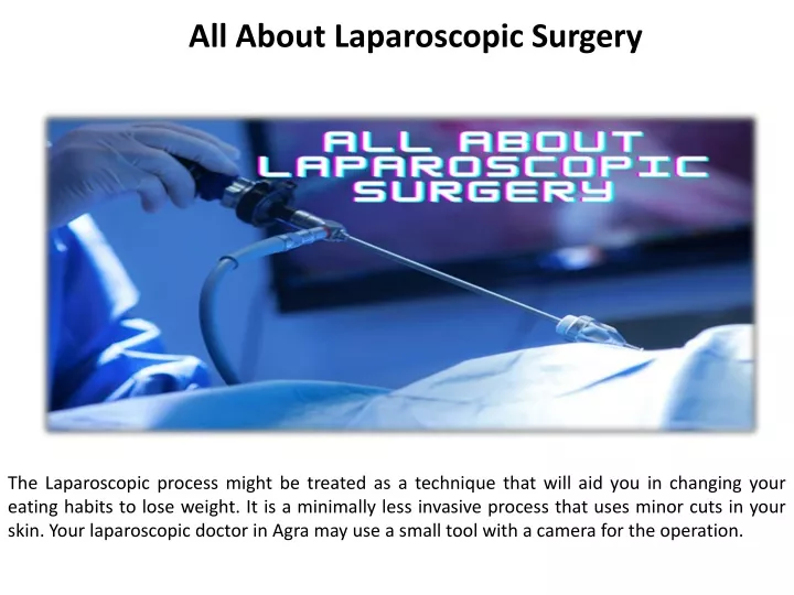 Ppt Laparoscopic Surgery Everything You Should Know Powerpoint