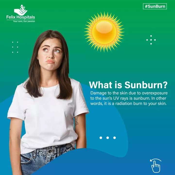 PPT - What is Sunburn? PowerPoint Presentation, free download - ID:11417032