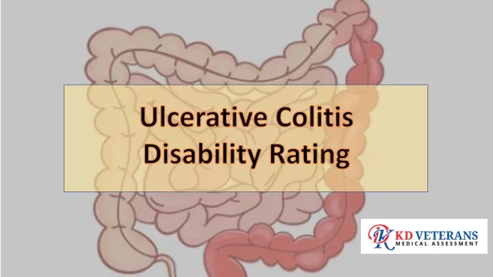 PPT - Ulcerative Colitis Causes And Risk Factors & VA Disability Rating ...