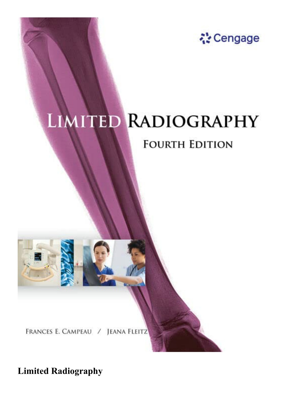 PPT - EPUB Limited Radiography PowerPoint Presentation, free download ...