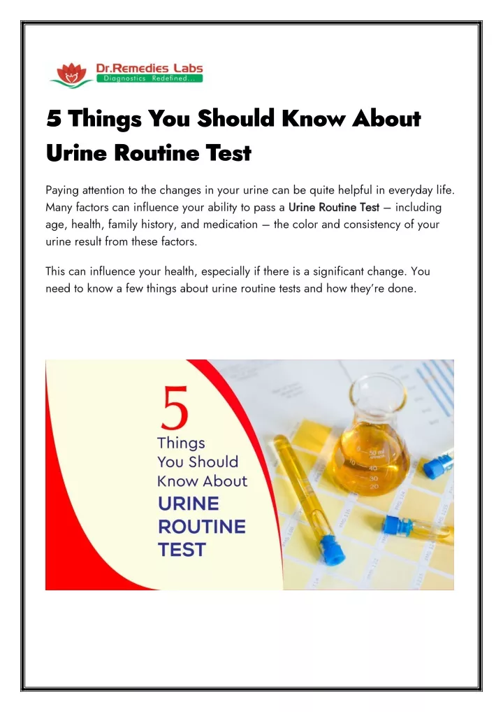 PPT - 5 Things You Should Know About Urine Routine Test PowerPoint ...