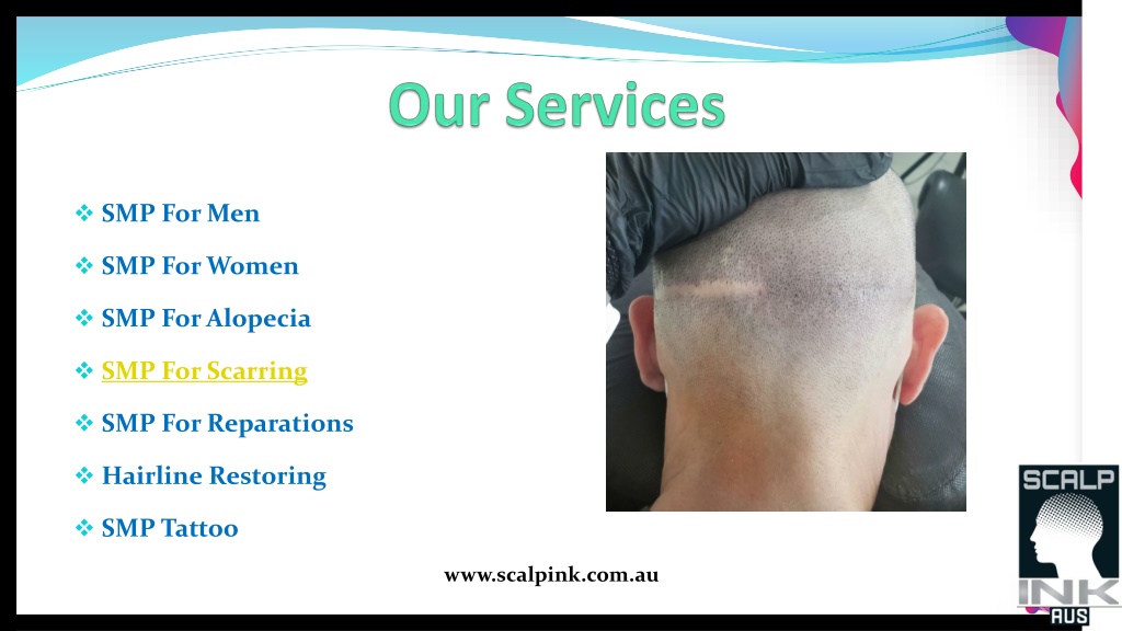 PPT - Best SMP Clinic in Melbourne and Sydney - Scalp Ink PowerPoint ...