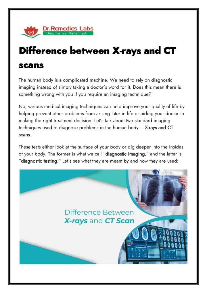 PPT - Difference between X-rays and CT scans PowerPoint Presentation ...