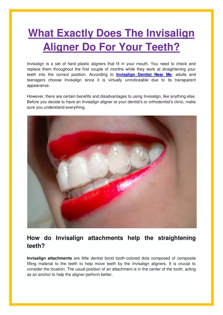 PPT - What Exactly Does The Invisalign Aligner Do For Your Teeth ...