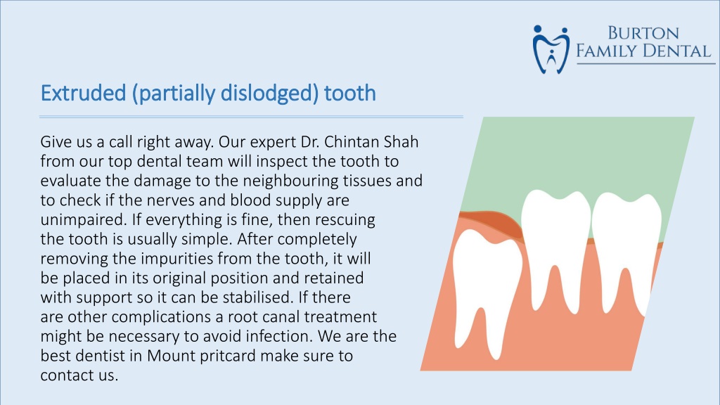 PPT - Emergency Dental Care in Burton MI PowerPoint Presentation, free ...