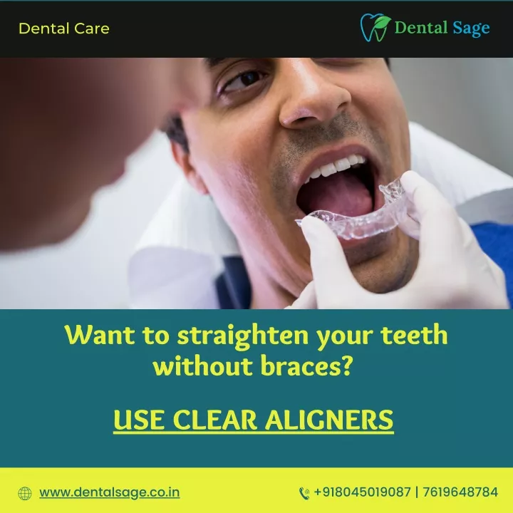 PPT - Use Clear Aligners| Best Dental Clinic in Yelahanka | Dental Sage ...