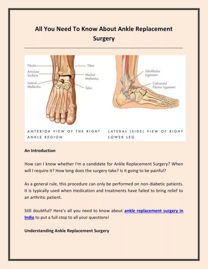 PPT - All You Need To Know About Ankle Replacement Surgery PowerPoint ...