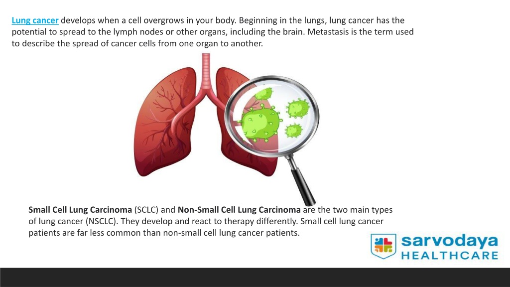 PPT - Lung Cancer: Symptoms, Causes, Risks, and Treatment PowerPoint ...