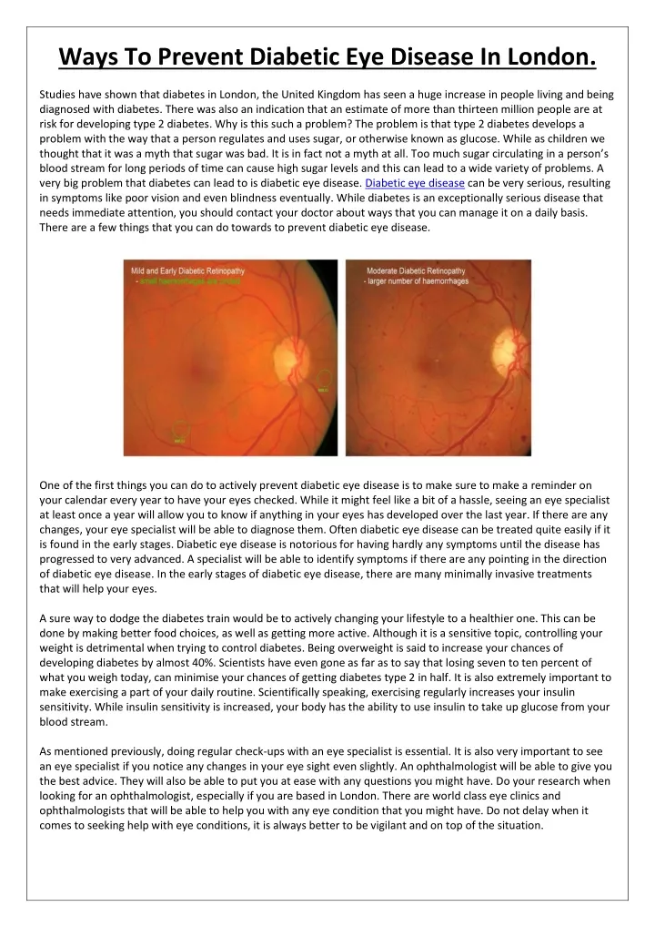 Ppt Ways To Prevent Diabetic Eye Disease In London Powerpoint