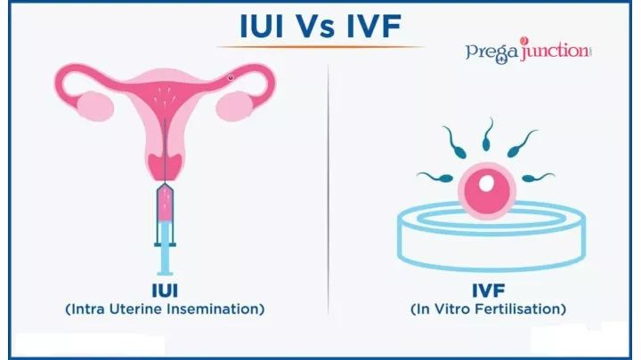 PPT - Why IUI and IVF is Needed PowerPoint Presentation, free download ...
