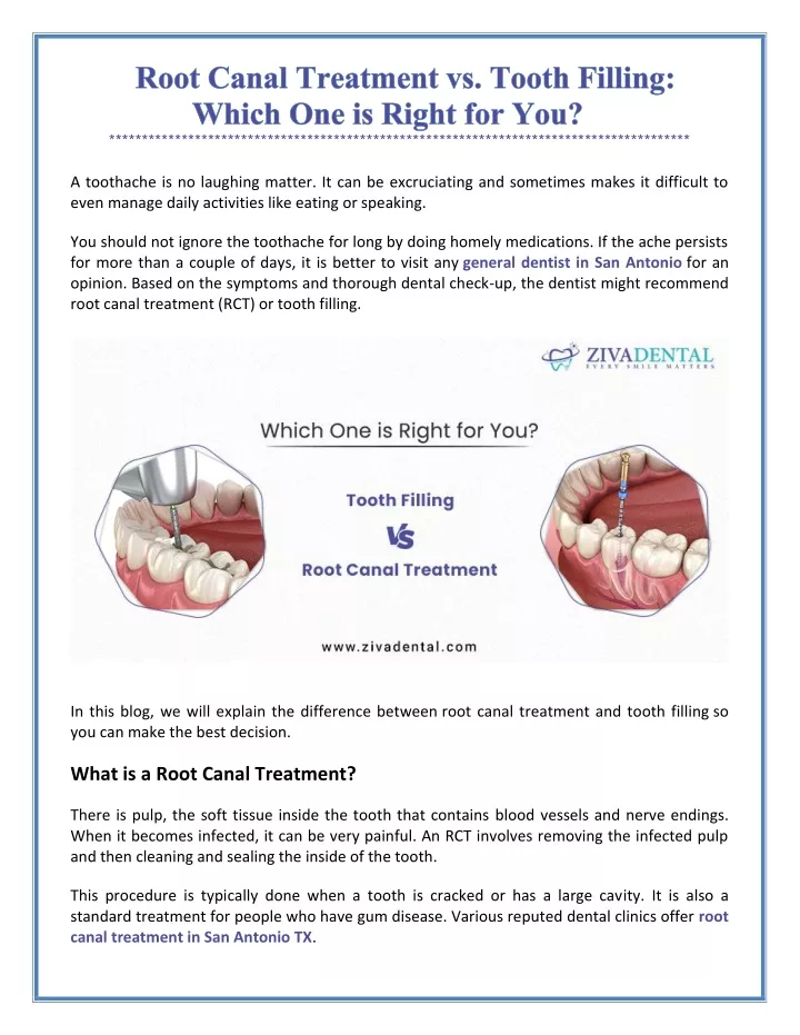 PPT - Root Canal Treatment vs Tooth Filling: Which One is Right for You ...