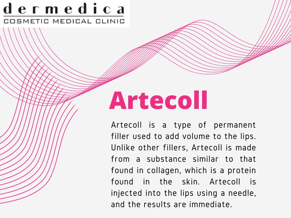 PPT - Best Lip Fillers in Perth PowerPoint Presentation, free download ...