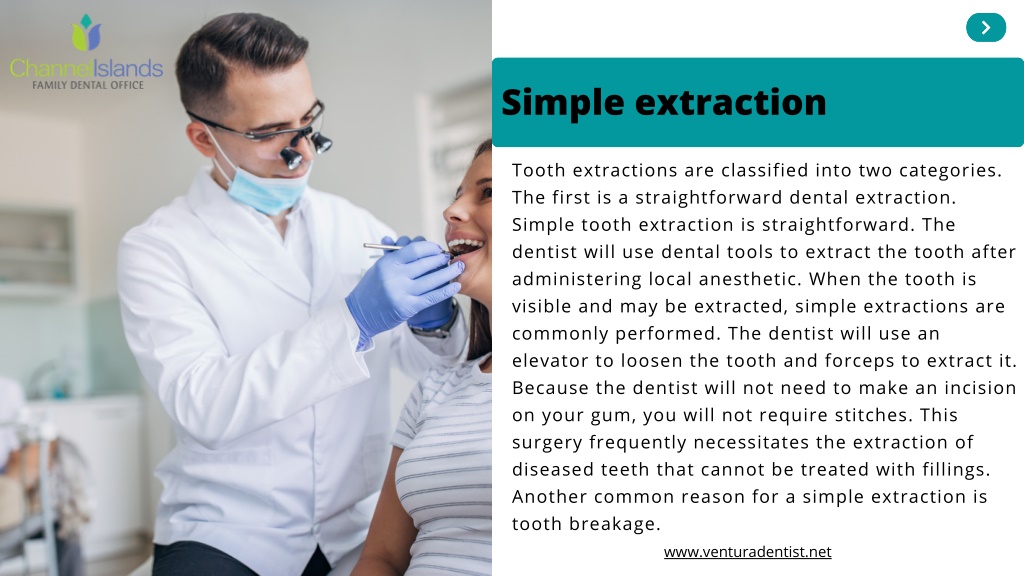 PPT - Top Notch Ventura Dentist - Ventura Dentist PowerPoint ...