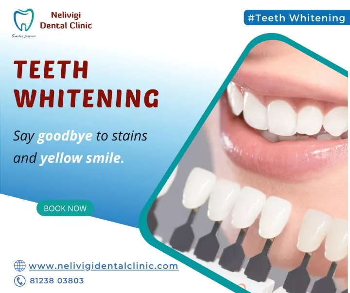 Ppt Say Goodbye To Teeth Stains Dental Clinic In Bellandur