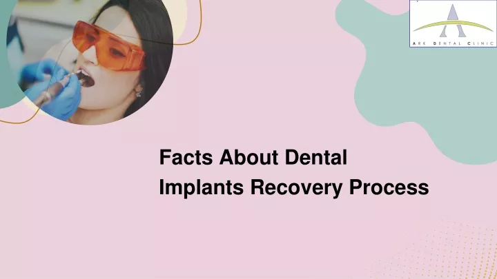 PPT - Facts About Dental Implants Recovery Process PowerPoint Presentation - ID:11563777