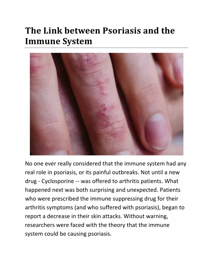 PPT - The Link between Psoriasis and the Immune System PowerPoint ...