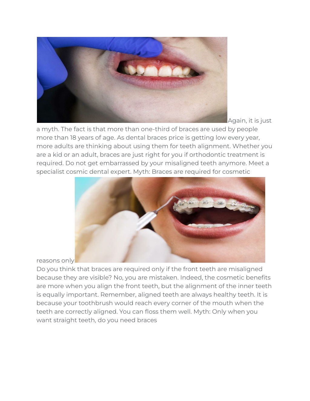 PPT - Dental myths about dental braces | Best dentist in bangalore ...
