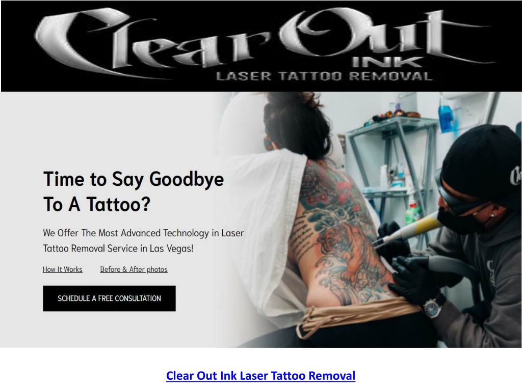 PPT - Clear Out Ink Laser Tattoo Removal PowerPoint Presentation, free ...