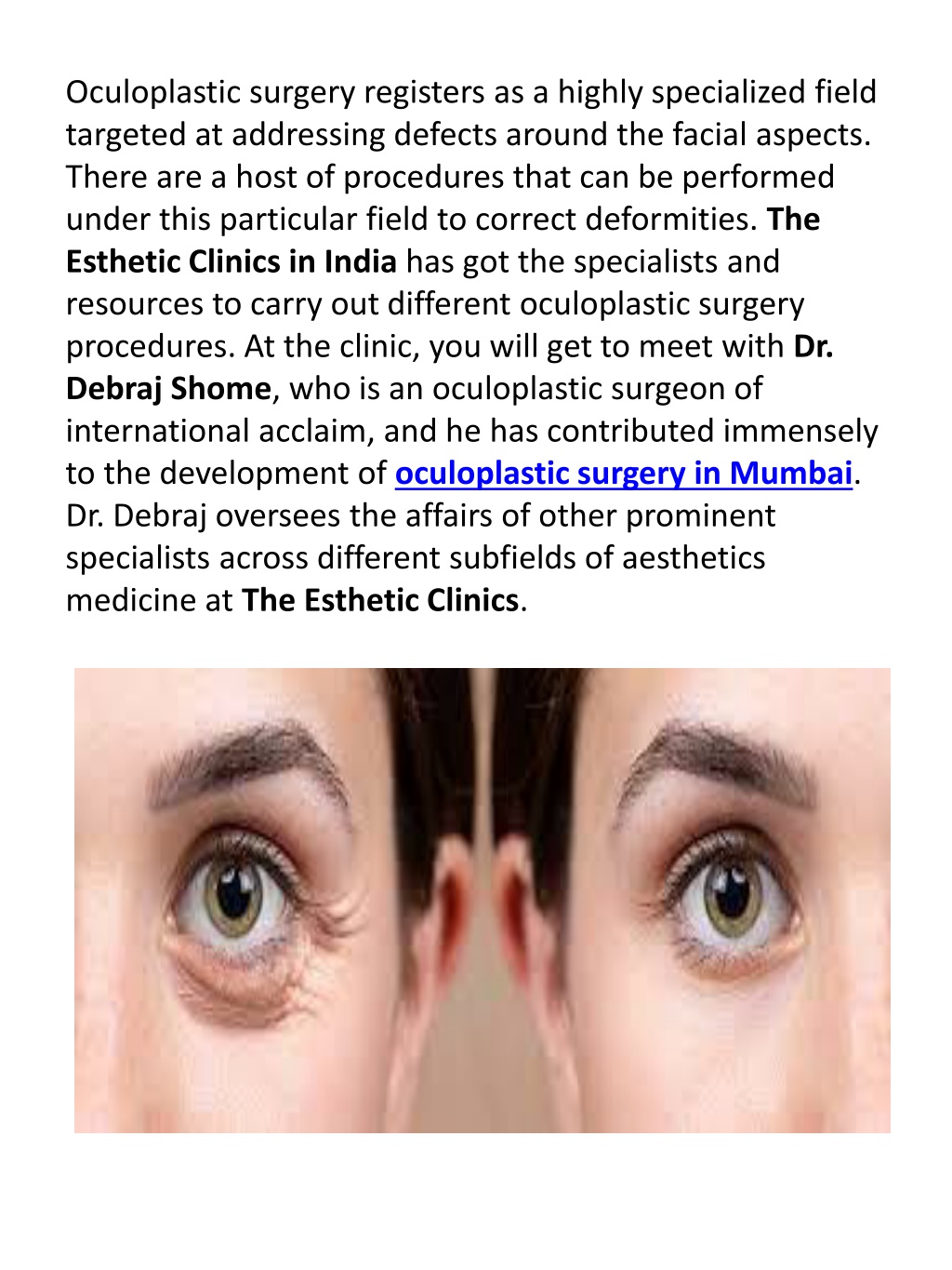 PPT - Oculoplastic Surgery in Mumbai PowerPoint Presentation, free ...