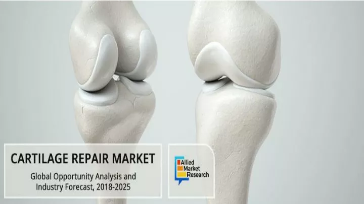 PPT - Cartilage Repair Market PowerPoint Presentation, free download ...