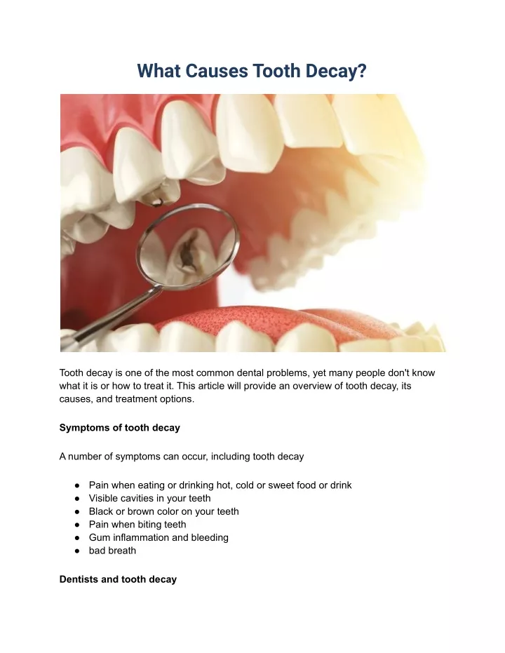 PPT - What Causes Tooth Decay PowerPoint Presentation, free download ...