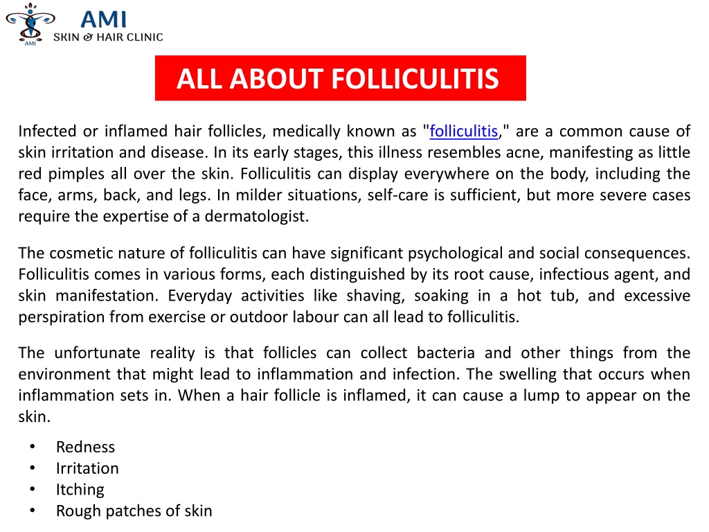 PPT - ALL ABOUT FOLLICULITIS PowerPoint Presentation, free download - ID:11637097
