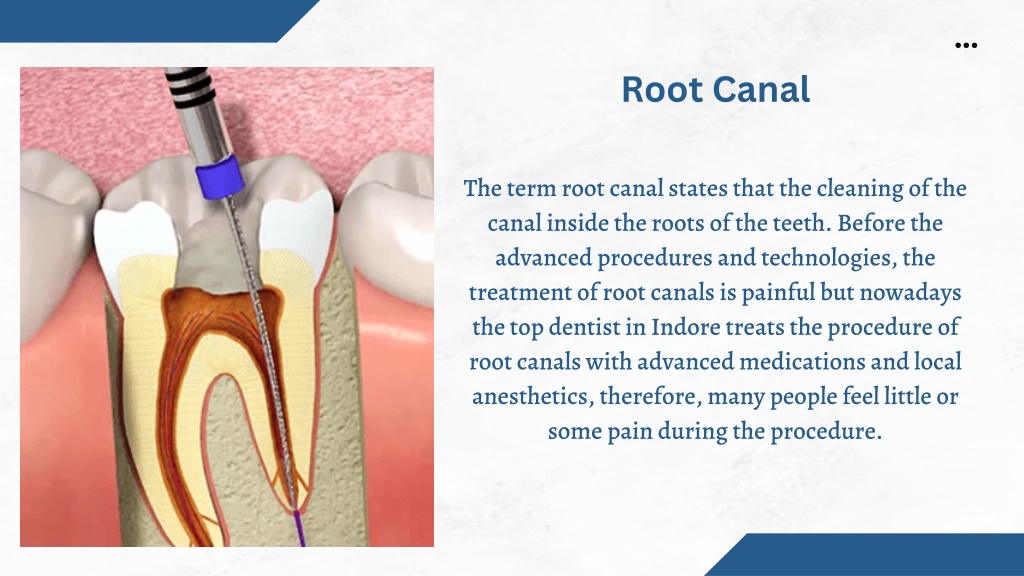 PPT - Find Top Dental Clinic in Indore – Surana Dental Clinic ...