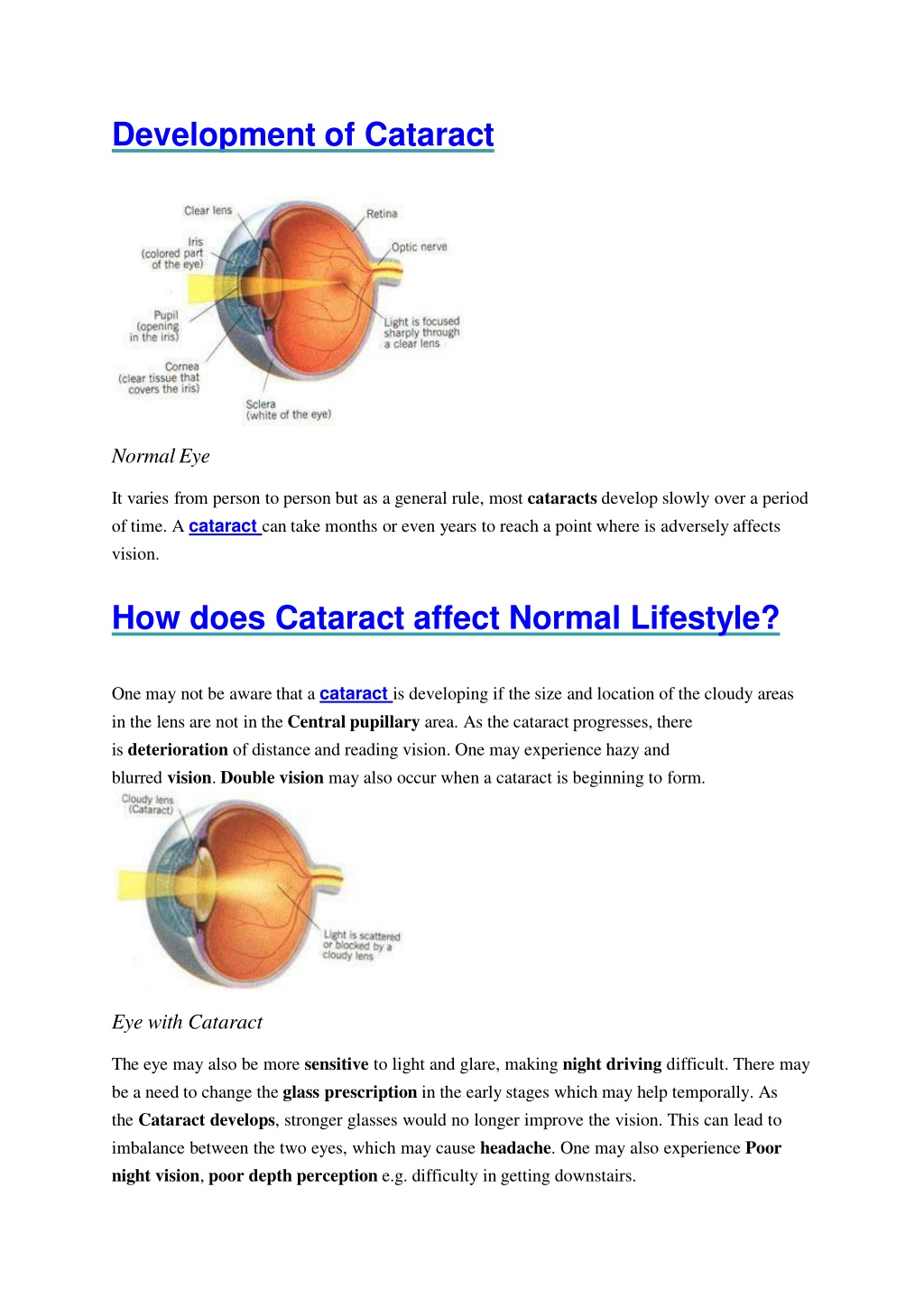 PPT - Cataract Surgery In India By the Best Cataract Surgeon Dr. Niteen ...