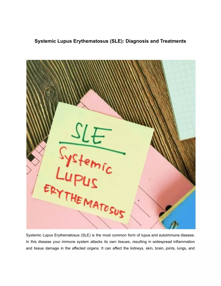 PPT - Systemic Lupus Erythematosus (SLE)_ Diagnosis and Treatments ...