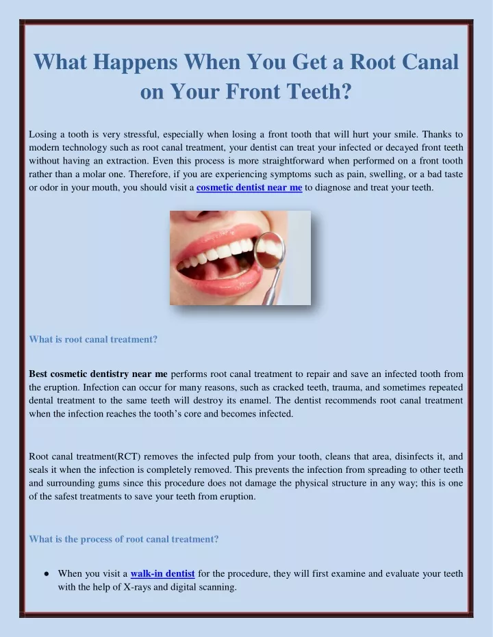 PPT - What Happens When You Get a Root Canal on Your Front Teeth ...