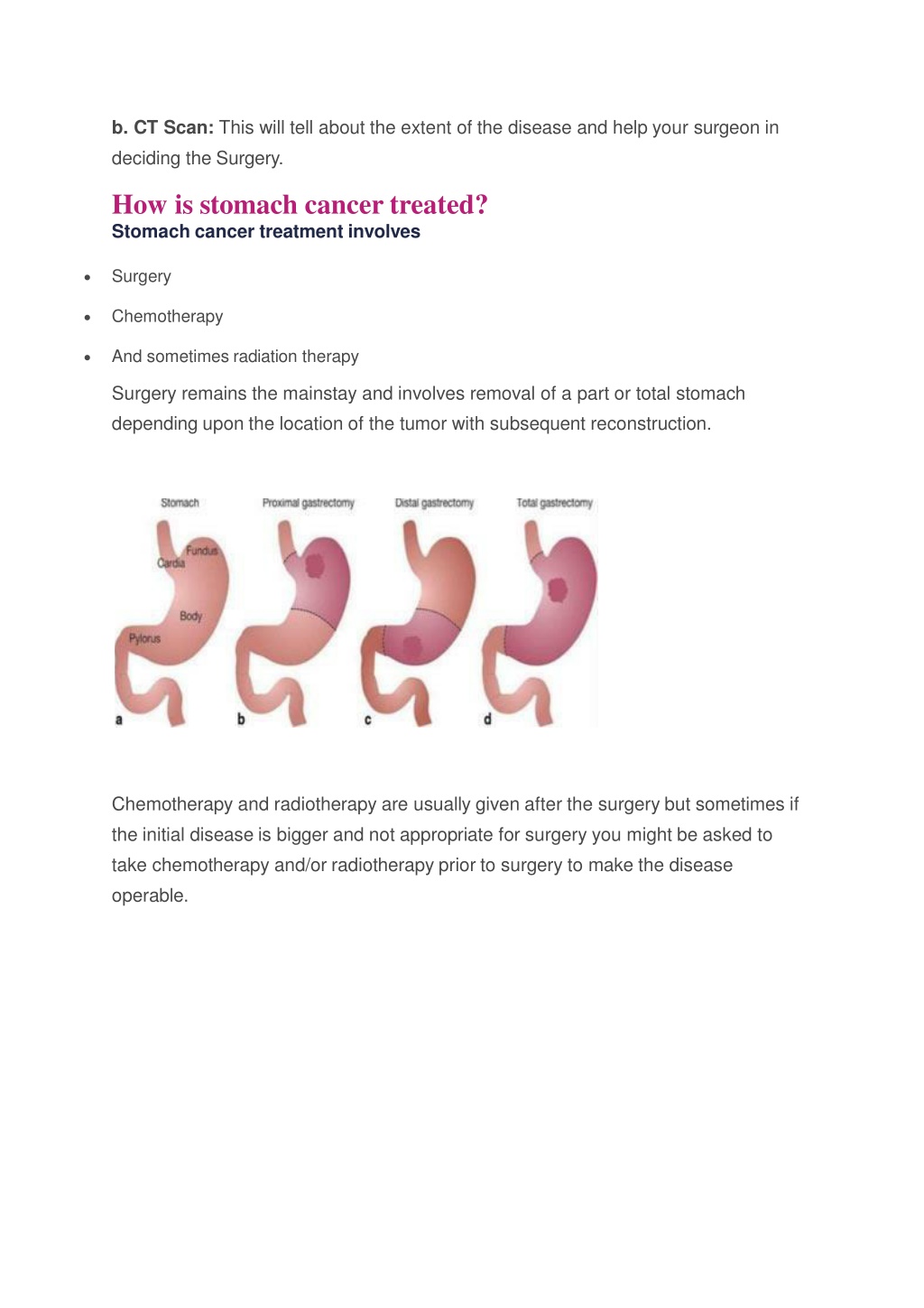 Ppt Stomach Cancer Treatment In Delhi By Dr Neeraj Goel Cancer