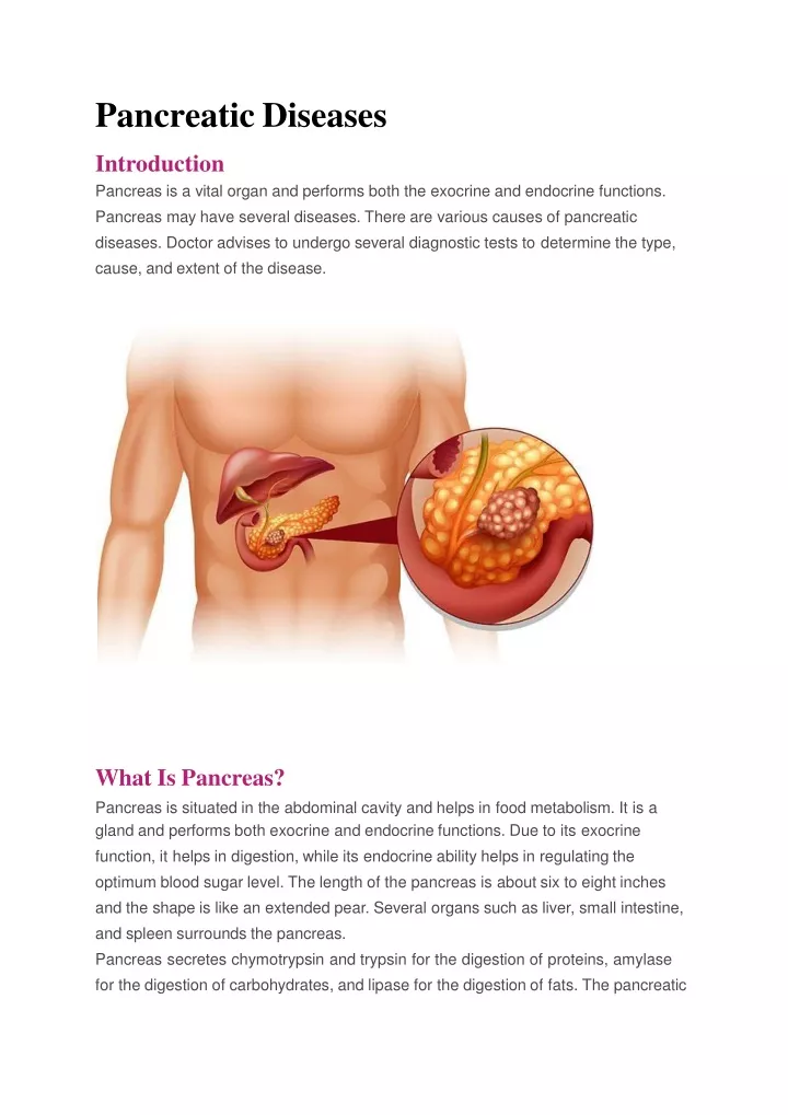 Ppt Pancreatic Diseases And Pancreatic Treatment In Delhi Dr