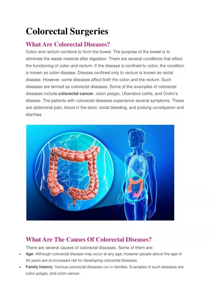 PPT - Colorectal Surgery In Delhi for Treating Colorectal Cancer By Dr ...