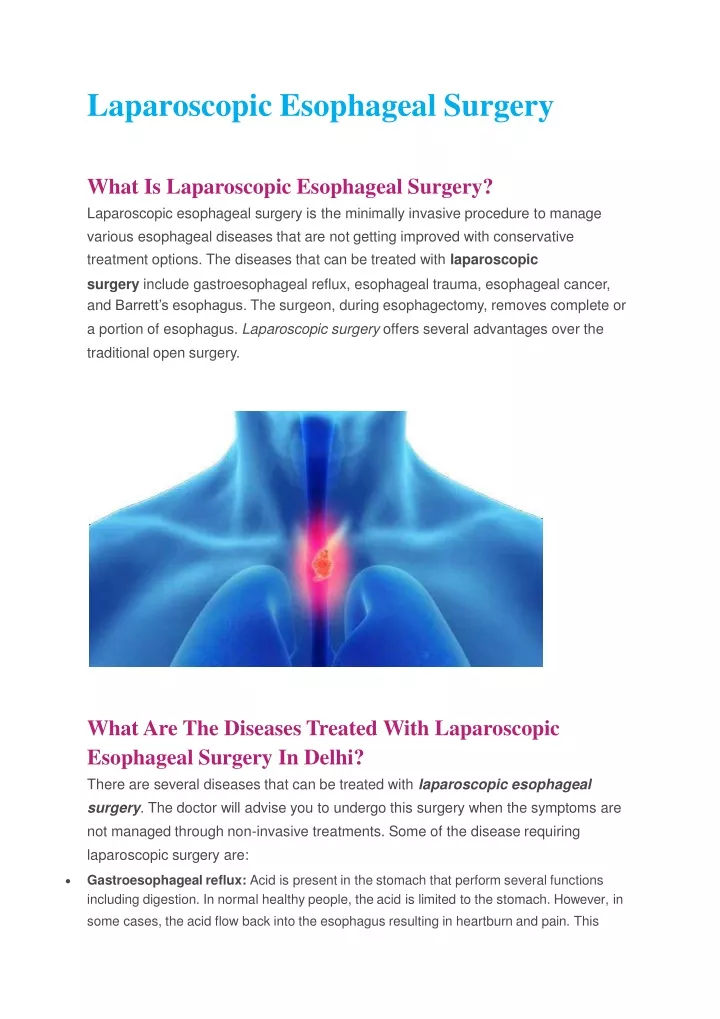 Ppt Laparoscopic Esophageal Surgery In Delhi By The Top Surgeon Dr