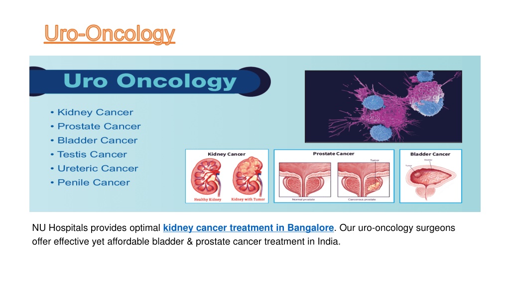 PPT - Best Nephrology Urology Hospital in Bangalore PowerPoint ...