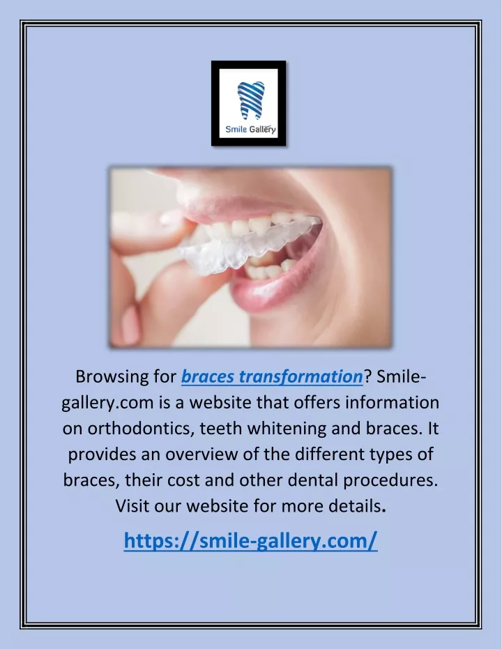PPT - Braces Transformation | Smile-gallery.com PowerPoint Presentation ...