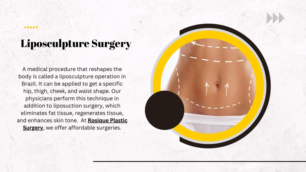 PPT - Get Liposculpture Surgery In Brazil PowerPoint Presentation, free ...