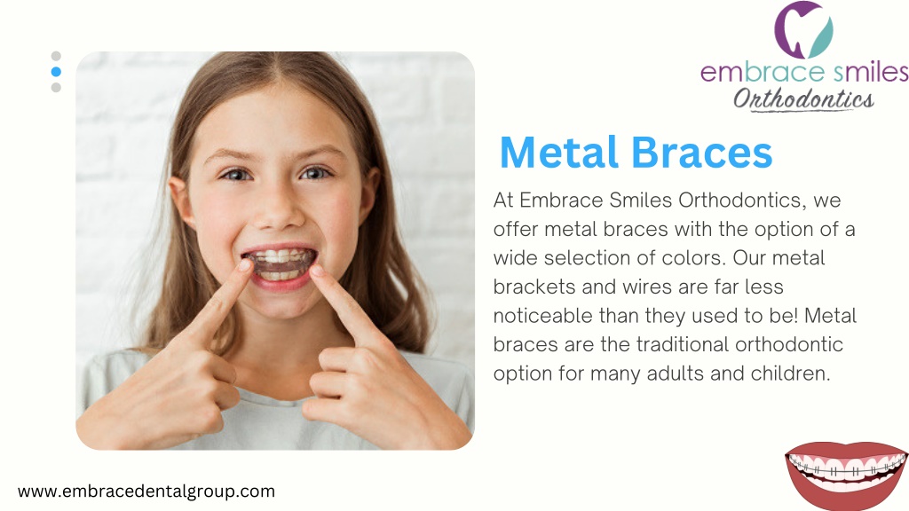 PPT - Embrace Smiles Orthodontics in Saratoga serving nearby areas in ...