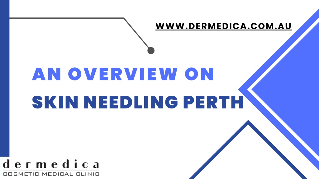 Ppt An Overview On Skin Needling Perth Powerpoint Presentation Free