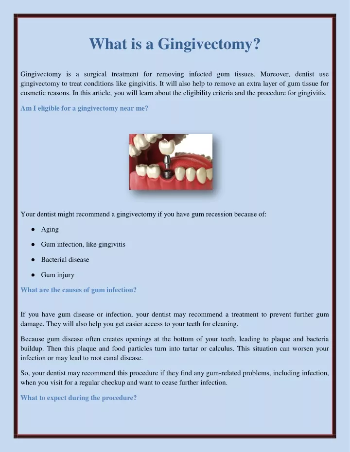 PPT - What is a Gingivectomy PowerPoint Presentation, free download ...