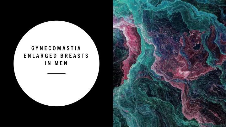 Ppt Gynecomastia Enlarged Breast In Men Powerpoint Presentation Free