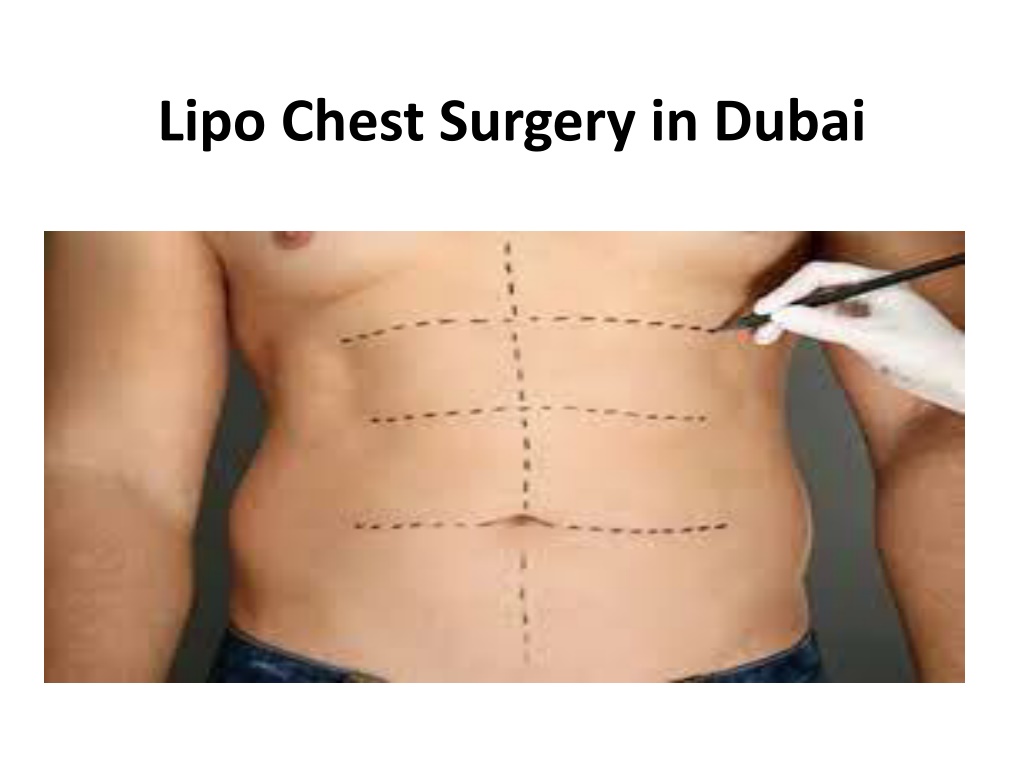 Ppt Lipo Chest Surgery In Dubai Powerpoint Presentation Free