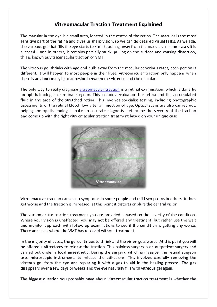 PPT - Vitreomacular Traction Treatment Explained PowerPoint ...
