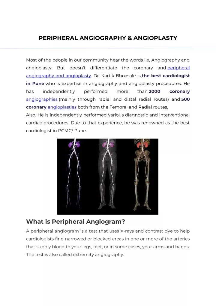 PPT - PERIPHERAL ANGIOGRAPHY & ANGIOPLASTY PowerPoint Presentation ...